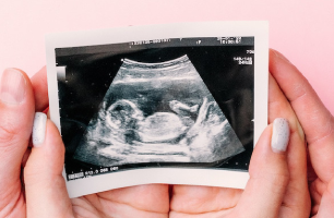 Fetal Scans in Jaipur | 3D/4D Ultrasound at Dr. Shweta’s